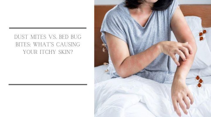 Dust Mites vs. Bed Bug Bites: What’s Causing Your Itchy Skin? - Avalon ...